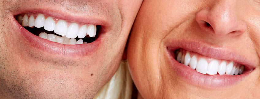All You Need To Know About Caries Management | tooth decay / tooth cavities